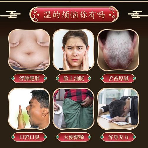 参苓白术散能去湿气吗_服用多久见效-第1张图片-山城妙识 参苓白术散能去湿气吗_服用多久见效-第1张图片-山城妙识