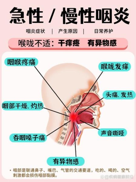 喉咙有异物感是怎么回事_怎么快速缓解-第1张图片-山城妙识
