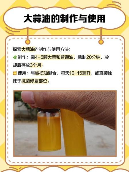 大蒜油多少钱一瓶_大蒜油价格影响因素-第2张图片-山城妙识 大蒜油多少钱一瓶_大蒜油价格影响因素-第2张图片-山城妙识