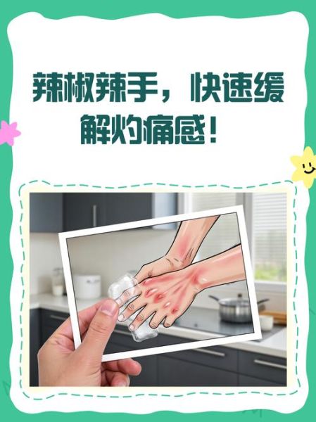 辣椒辣手怎么办_辣椒辣手危害有哪些-第3张图片-山城妙识