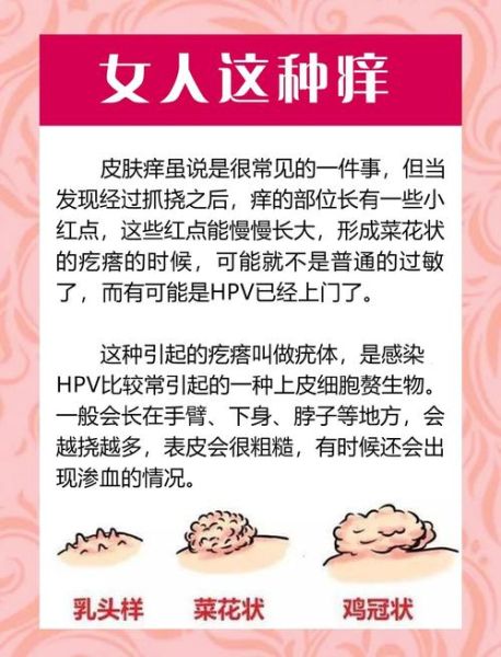 菜花病是怎么引起的_菜花病是什么引起的-第2张图片-山城妙识