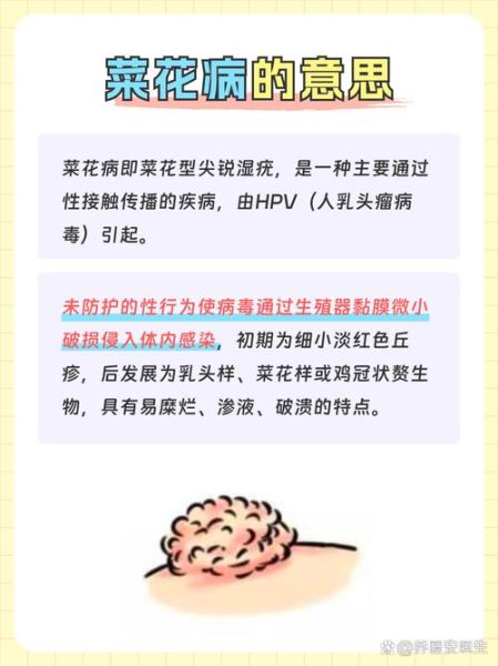 菜花病是怎么引起的_菜花病是什么引起的-第3张图片-山城妙识