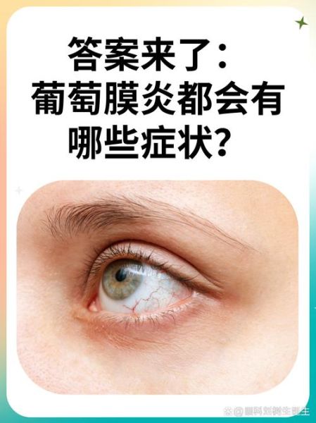 脉络膜是什么_脉络膜炎怎么治疗-第3张图片-山城妙识