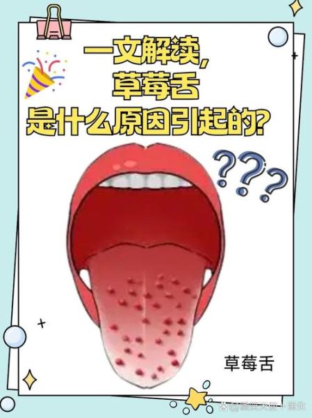草莓舌苔是怎么回事_草莓舌苔是病吗-第2张图片-山城妙识
