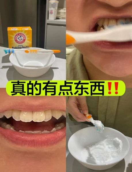 苏打粉能美白牙齿吗_小苏打美白牙齿正确方法-第1张图片-山城妙识