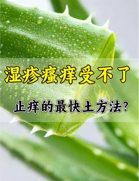 湿疹最怕的三个土办法_真的有用吗-第3张图片-山城妙识