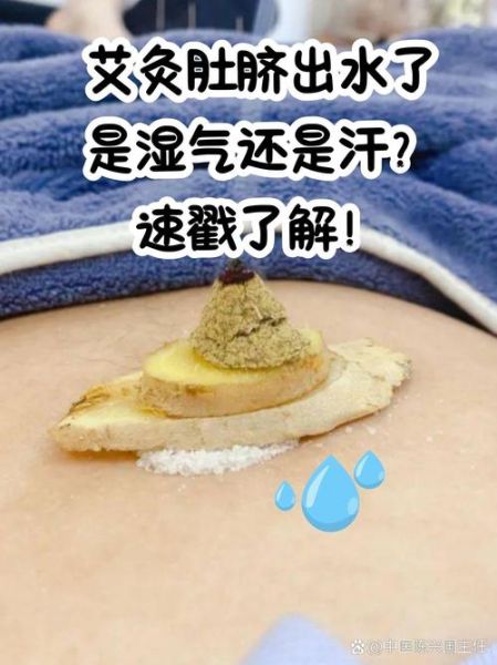 艾灸后怎么看湿气排出_湿气排出的表现有哪些-第1张图片-山城妙识