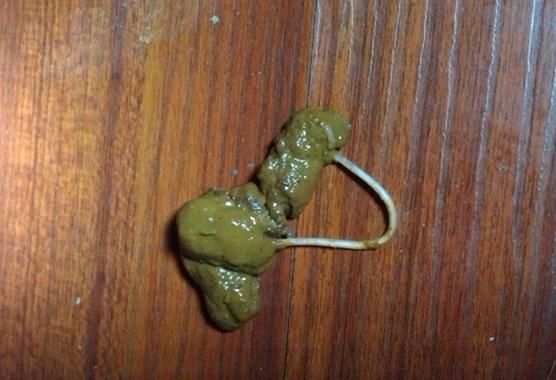 蛔虫图片_蛔虫长什么样-第2张图片-山城妙识