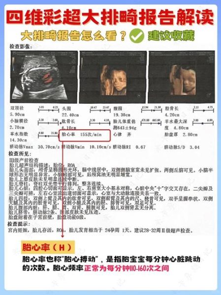 大排畸和四维一样吗_区别与选择指南-第1张图片-山城妙识 大排畸和四维一样吗_区别与选择指南-第1张图片-山城妙识