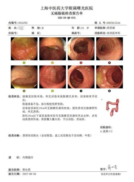肠胃炎不去看会自愈吗_肠胃炎多久能好-第1张图片-山城妙识 肠胃炎不去看会自愈吗_肠胃炎多久能好-第1张图片-山城妙识
