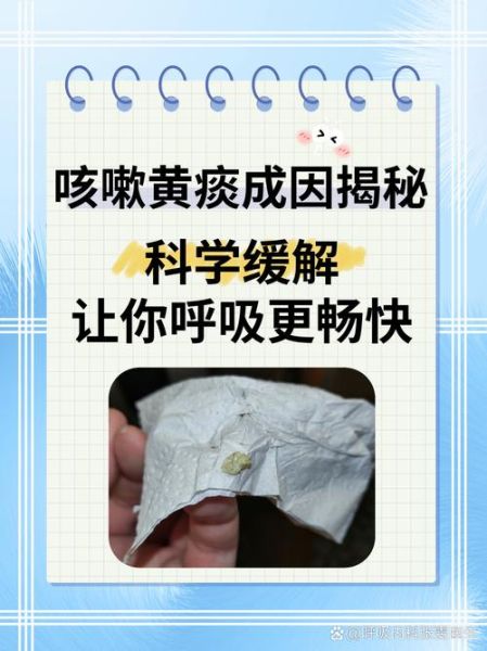 咳嗽有黄痰多久会自愈_黄痰几天能好-第1张图片-山城妙识 咳嗽有黄痰多久会自愈_黄痰几天能好-第1张图片-山城妙识