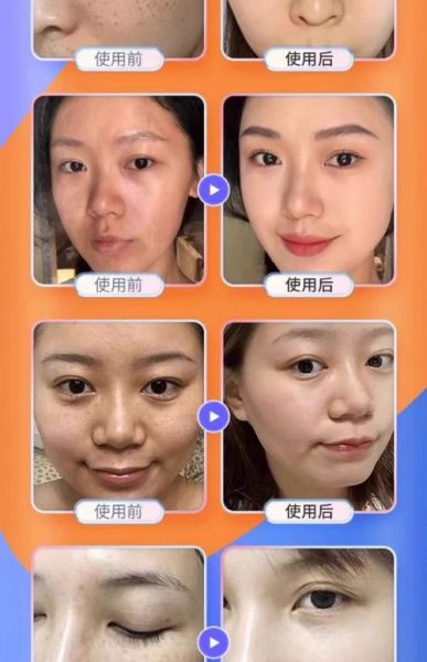 什么东西可以祛斑最快_祛斑效果最好的方法是什么-第3张图片-山城妙识 什么东西可以祛斑最快_祛斑效果最好的方法是什么-第3张图片-山城妙识