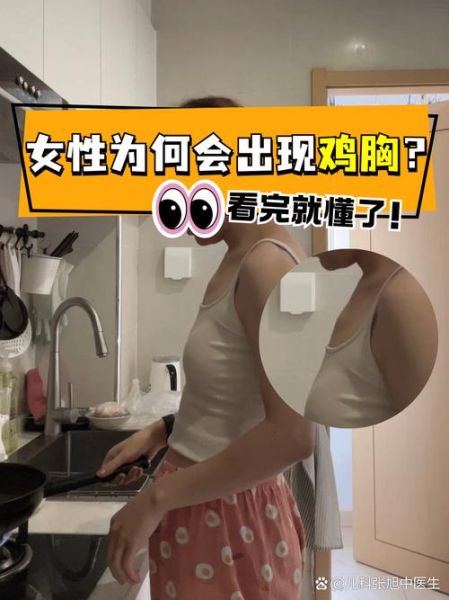 女性鸡胸怎么矫正_鸡胸手术多少钱-第3张图片-山城妙识