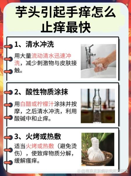 芋头手痒怎么快速止痒_芋头手痒用什么药-第1张图片-山城妙识