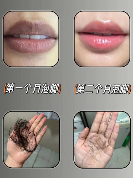 花椒水泡脚治脚气多久见效_花椒水治脚气正确步骤-第3张图片-山城妙识