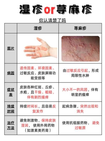 过敏症状图片怎么看_如何快速识别-第1张图片-山城妙识