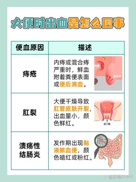 大便出血鲜红不痛是什么原因_严重吗-第1张图片-山城妙识 大便出血鲜红不痛是什么原因_严重吗-第1张图片-山城妙识