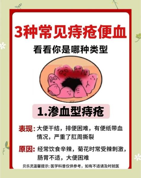 大便出血鲜红不痛是什么原因_严重吗-第3张图片-山城妙识 大便出血鲜红不痛是什么原因_严重吗-第3张图片-山城妙识