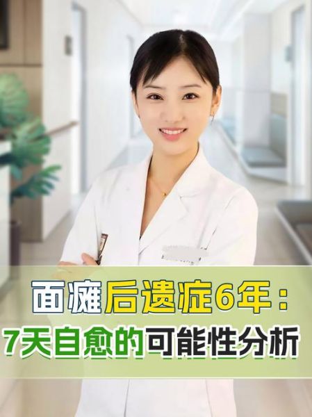 面瘫是什么原因引起的_面瘫会自愈吗-第3张图片-山城妙识 面瘫是什么原因引起的_面瘫会自愈吗-第3张图片-山城妙识