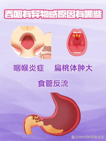 可以正常吞咽但有异物感_喉咙堵得慌怎么办-第1张图片-山城妙识