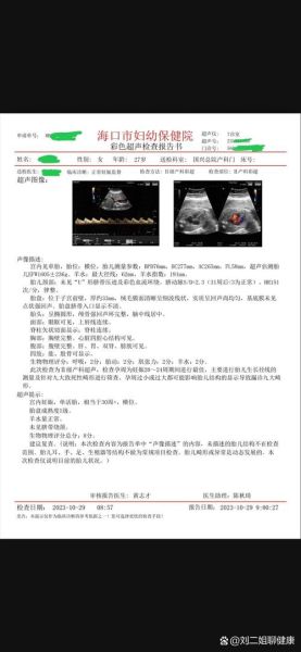 小排畸最佳时间是多少周_小排畸检查注意事项-第2张图片-山城妙识
