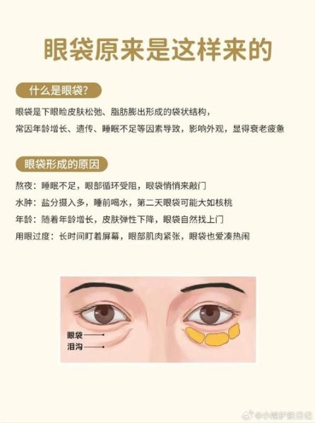 去眼袋最有效的土方法_眼袋怎么消除最快-第1张图片-山城妙识 去眼袋最有效的土方法_眼袋怎么消除最快-第1张图片-山城妙识