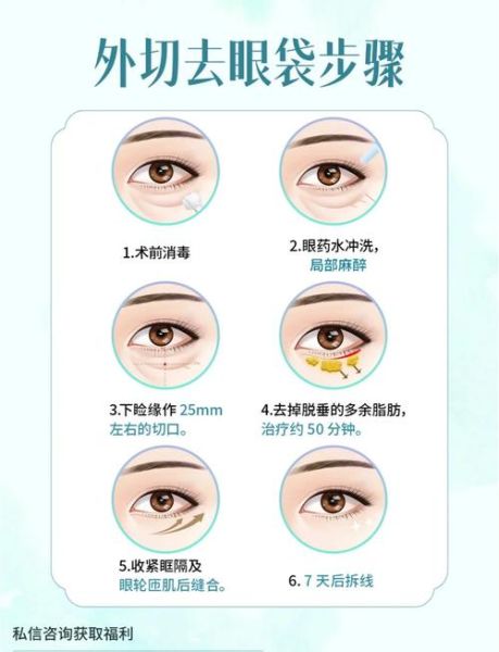 去眼袋最有效的土方法_眼袋怎么消除最快-第2张图片-山城妙识 去眼袋最有效的土方法_眼袋怎么消除最快-第2张图片-山城妙识