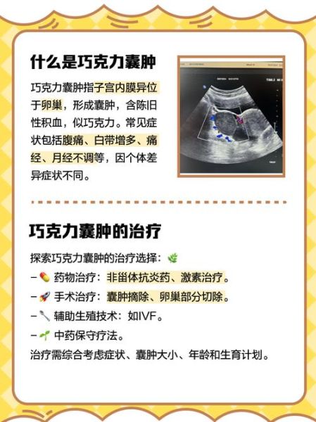 巧克力囊肿是恶性的还是良性的_巧克力囊肿会癌变吗-第1张图片-山城妙识