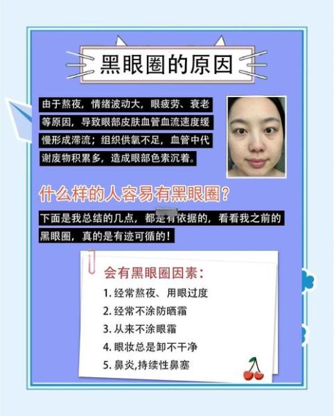 黑眼圈怎么才能快速消除_熬夜后如何急救-第1张图片-山城妙识