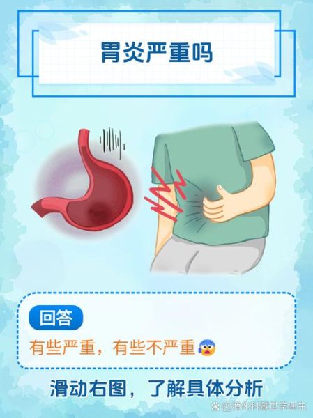 胃炎是什么原因引起的_胃炎是怎么得的-第1张图片-山城妙识