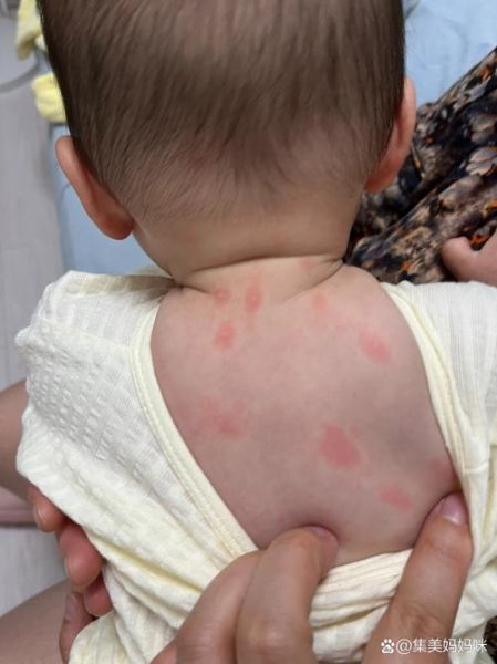 哪些人不宜吃猕猴桃_猕猴桃过敏症状有哪些-第1张图片-山城妙识