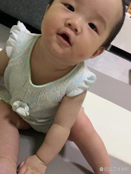 哪些人不宜吃猕猴桃_猕猴桃过敏症状有哪些-第2张图片-山城妙识