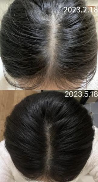 补肾粥21天白发变黑发是真的吗_如何正确熬制-第1张图片-山城妙识