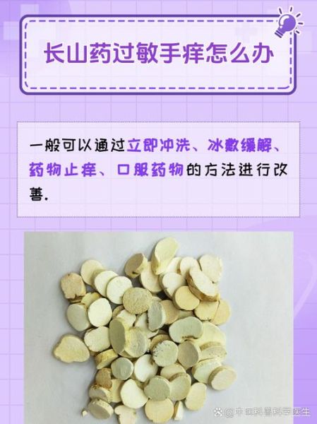 麻山药痒痒怎么办_麻山药手痒怎么快速止痒-第1张图片-山城妙识