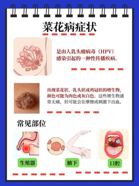 菜花病早期症状图片_菜花病初期长什么样-第2张图片-山城妙识