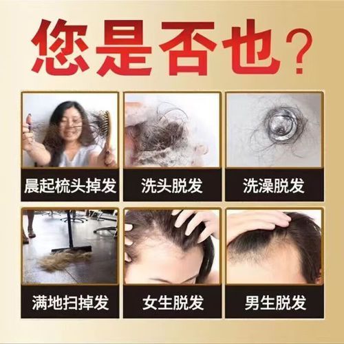 脱发吃什么药管用_脱发用药多久见效-第2张图片-山城妙识 脱发吃什么药管用_脱发用药多久见效-第2张图片-山城妙识