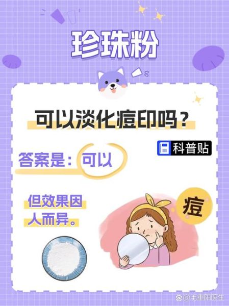 珍珠粉可以淡化痘印吗_珍珠粉去痘印效果怎么样-第2张图片-山城妙识