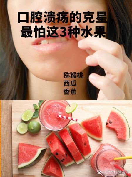 口腔溃疡吃什么水果好_哪些水果能缓解溃疡疼痛-第1张图片-山城妙识