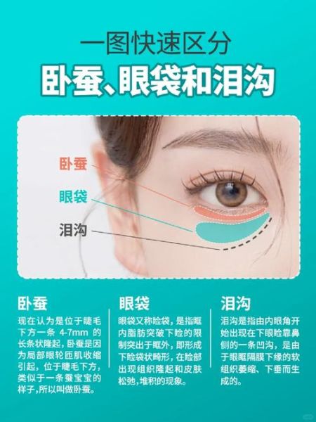 卧蚕怎么画_卧蚕和眼袋的区别-第2张图片-山城妙识 卧蚕怎么画_卧蚕和眼袋的区别-第2张图片-山城妙识