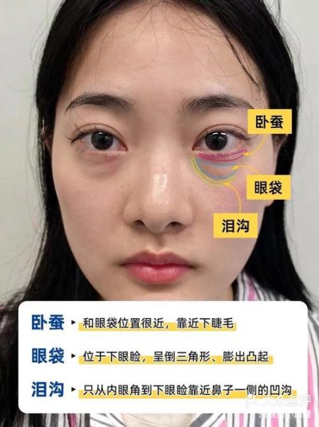 卧蚕怎么画_卧蚕和眼袋的区别-第1张图片-山城妙识 卧蚕怎么画_卧蚕和眼袋的区别-第1张图片-山城妙识