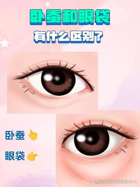 卧蚕怎么画_卧蚕和眼袋的区别-第3张图片-山城妙识 卧蚕怎么画_卧蚕和眼袋的区别-第3张图片-山城妙识