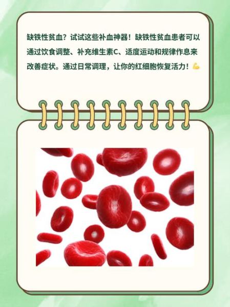 缺铁性贫血吃什么补血最快_贫血到什么程度会死人-第1张图片-山城妙识