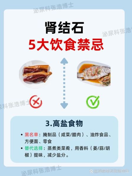 肾结石饮食注意什么_肾结石不能吃什么-第1张图片-山城妙识