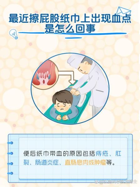 大便后擦屁股纸上会有血怎么回事_肛门出血原因-第1张图片-山城妙识 大便后擦屁股纸上会有血怎么回事_肛门出血原因-第1张图片-山城妙识