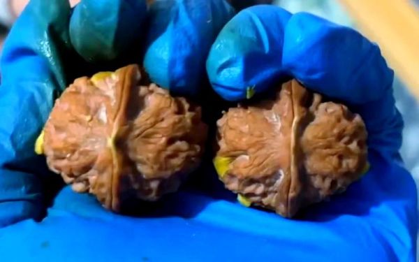 青皮核桃汁怎么洗掉_青皮核桃汁弄到手上怎么去除-第1张图片-山城妙识