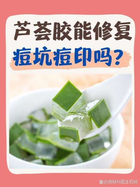 芦荟胶用完后要洗脸吗_芦荟胶需要洗掉吗-第1张图片-山城妙识 芦荟胶用完后要洗脸吗_芦荟胶需要洗掉吗-第1张图片-山城妙识