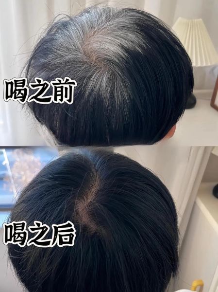白发变黑发最好的土方法_白发变黑发偏方真的有用吗-第2张图片-山城妙识