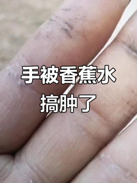 香蕉水能用手碰吗_香蕉水皮肤接触危害-第2张图片-山城妙识