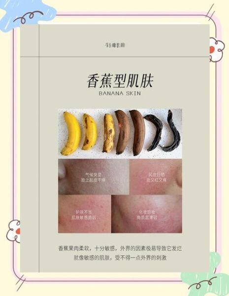 香蕉水能用手碰吗_香蕉水皮肤接触危害-第3张图片-山城妙识
