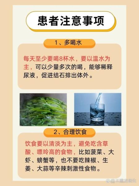 肾结石严重吗_肾结石能自愈吗-第1张图片-山城妙识
